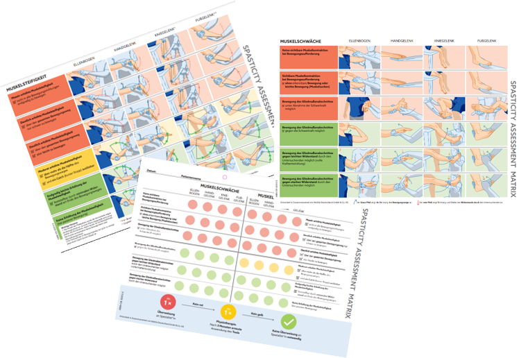 Spastik nach Schlaganfall | AbbVie Pro Deutschland