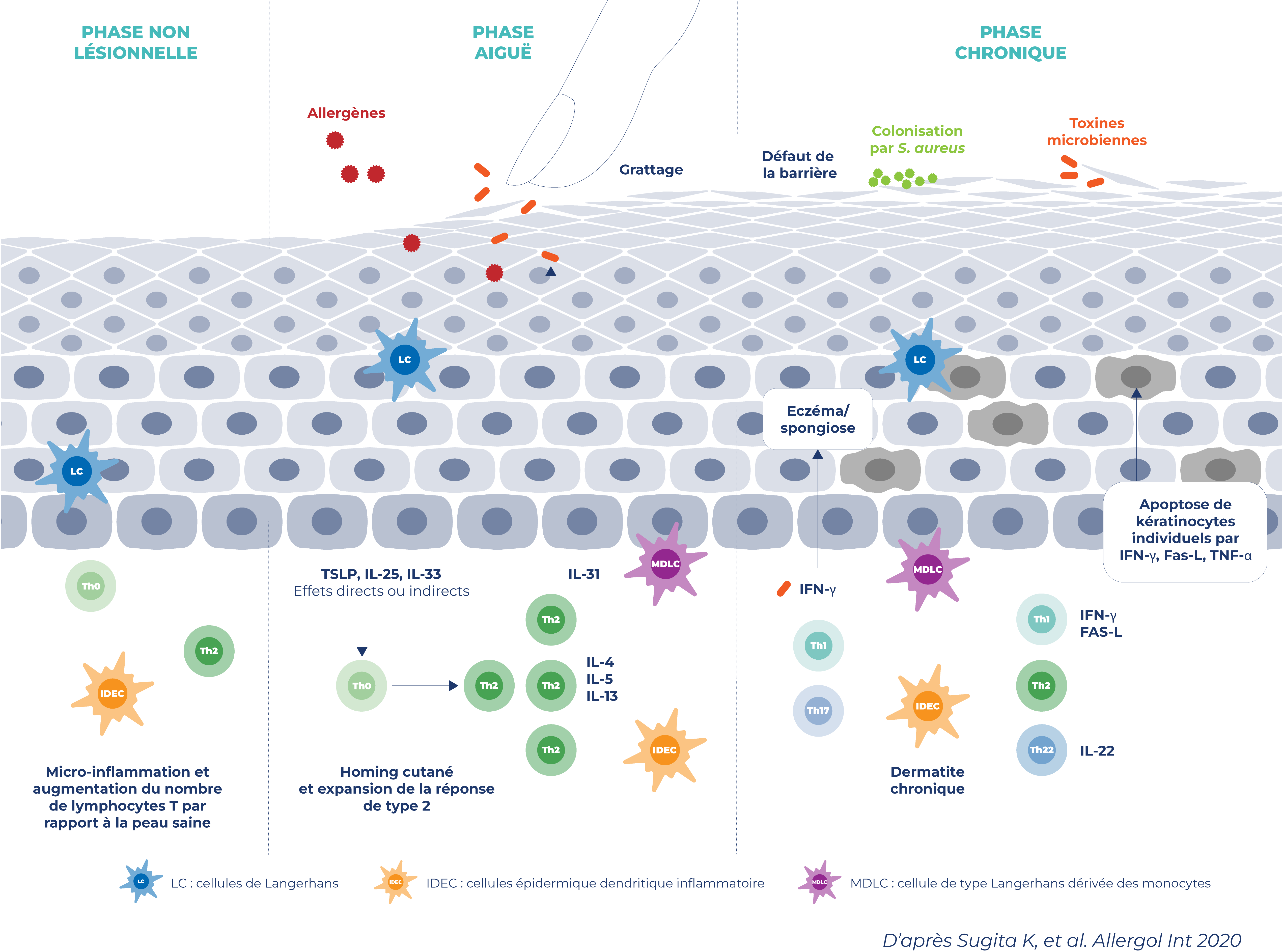 La dermatite atopique : aider le patient à mieux comprendre sa maladie