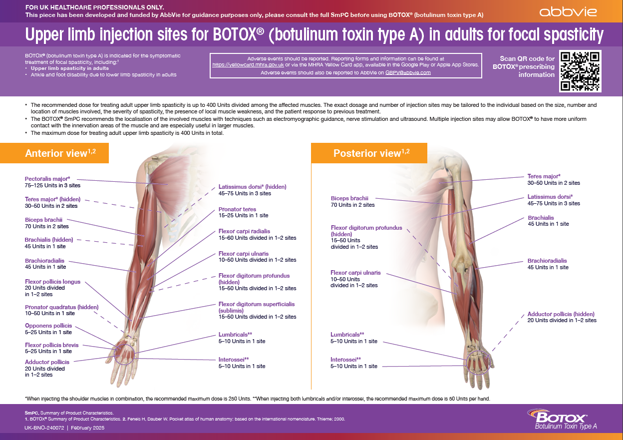 upper limb spasticity post stroke